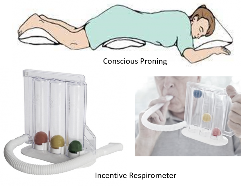 Post-COVID Care and Recovery - 5 Important Points