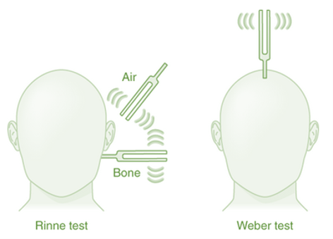 Hearing Loss – 5 Important Points of Awareness and Understanding